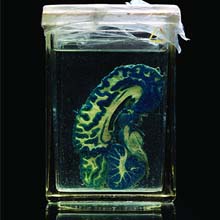 Photos of UT's "Brain Museum" Featured in Washington Post>